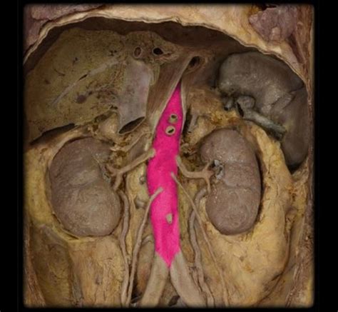 Peripheral Vasculature Lab Flashcards Quizlet