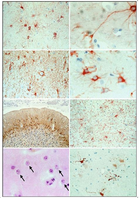 Cytology Of The CNS