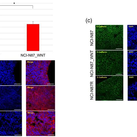 Increased Activity Of Wnt Signaling Pathway Of Gastric Cancer Cells