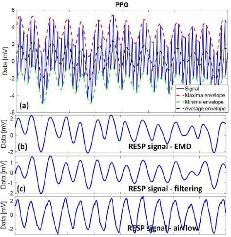Figure 3 From A Portable Multisensor System To Assess Cardiorespiratory