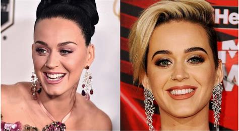 Katy Perry Teeth The Secret Behind Her Dazzling Smile