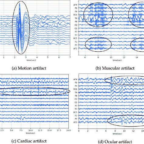 pdf wavelets for eeg analysis