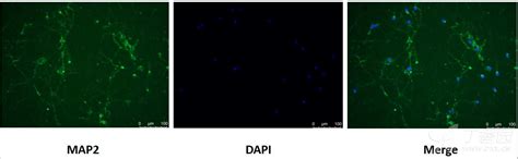 神经元原代培养技术交流 丁香园论坛