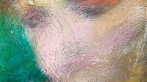 Stroke Management The Outpatient Perspective