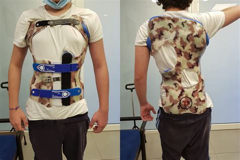 Spine Deformities Tannouri Orthopedics
