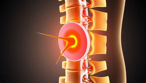 Understanding Nerve Compression Causes Symptoms And Treatment Options