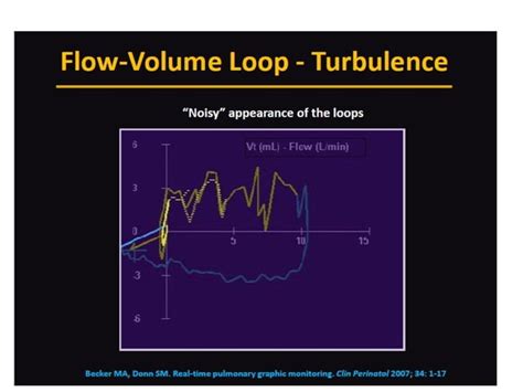 Interpretation Of Ventilator Graphics Ppt