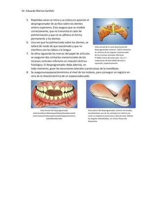 Confección De Un Desprogramador Anterior Docx
