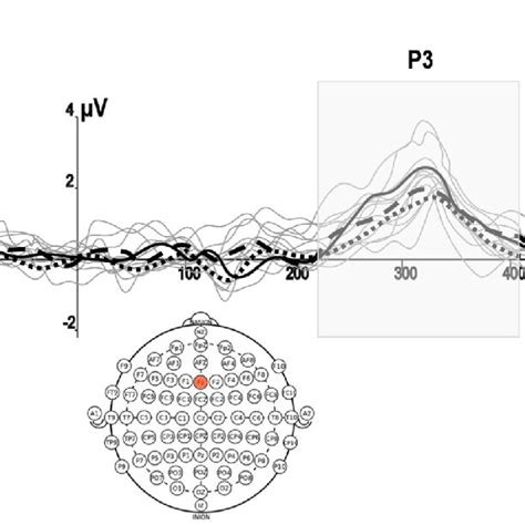 Representative Event Related Potential Waveform At Pz For The Three