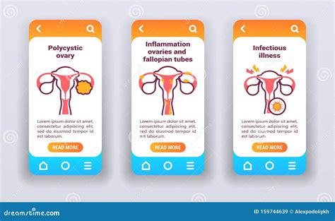 Female Reproductive Disease On Mobile App Onboarding Screens Stock Vector Illustration Of