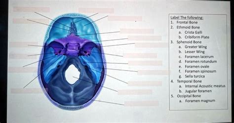 Label The Following 1 Frontal Bone 2 Ethmoid Bone A Crista Galli B