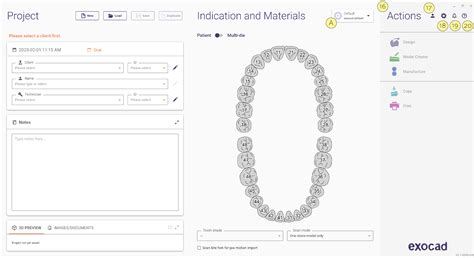 Filedb 31 Sr 6png Exocad
