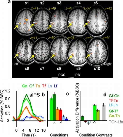 Individual Statistical Maps And Activation Levels Across Conditions For Download Scientific