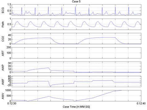 Case 5 Waveform Plots 10 Second Plots
