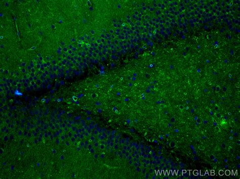 Agerrage Antibody 83759 4 Rr Proteintech