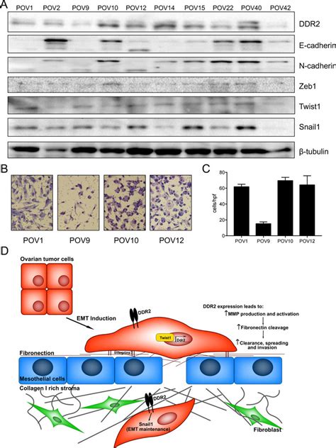 Ddr2 Expression Correlates With Increased Invasion Of Patient Derived