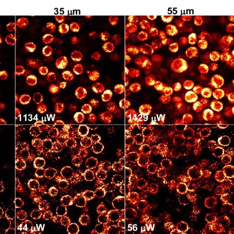 Two Photon Imaging Of Cancer Cells Embedded In A Collagen Matrix At Download Scientific Diagram