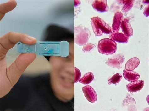 Keychain Sized Microscope Invented By A Pinoy Wins Dyson Award