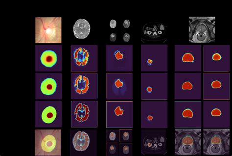 Segmentation Results Of Different Strategies For Five Different Medical
