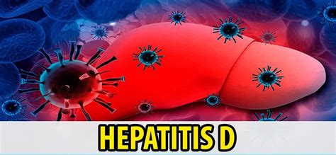 Hepatitis D Causes Symptoms And Treatments Healthtian