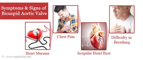 Bicuspid Aortic Valve Causes Symptoms Complications Diagnosis