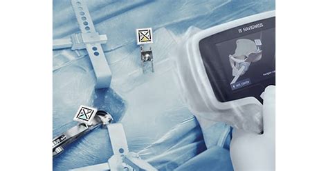 Naviswiss Reaches 1000th Navigated Thr Orthoworld