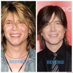 John Rzeznik Plastic Surgery Photos Before And After Surgery4