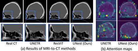 Witunet A U Shaped Architecture Integrating Cnn And Transformer For