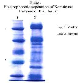 Electrophoretic Separation Of Keratinase Enzyme Of Bacillus Sp