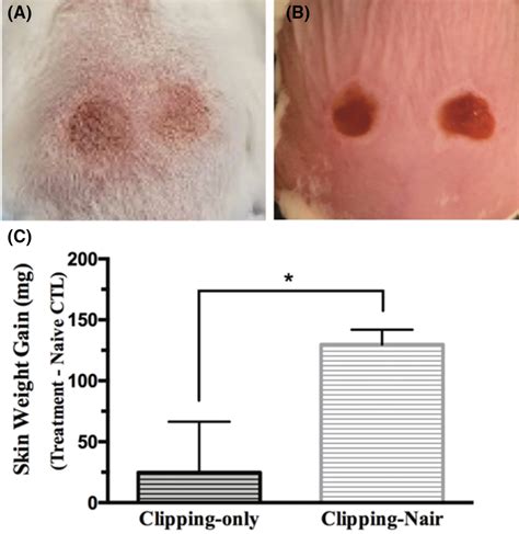 Effect Of Hair Removal Method On Mechlorethamine Hydrochloride Nm