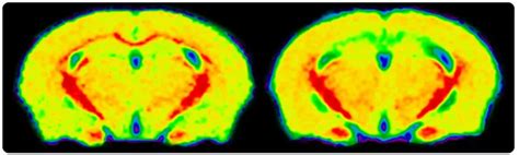 Cuprizone Mouse Models Of Multiple Sclerosis Ms