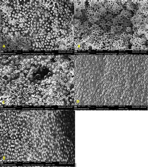 Examples Of Sem Images Obtained From Different Groups A Cni B Download Scientific Diagram