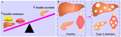 Triglycerides Glucose Metabolism And Type 2 Diabetes
