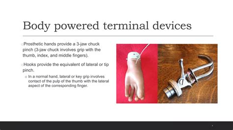 Upper Limb Prostheses Pptx