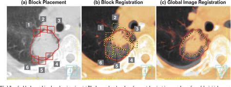 Figure 1 From A Block Matching Based Registration Algorithm For Localization Of Locally Advanced