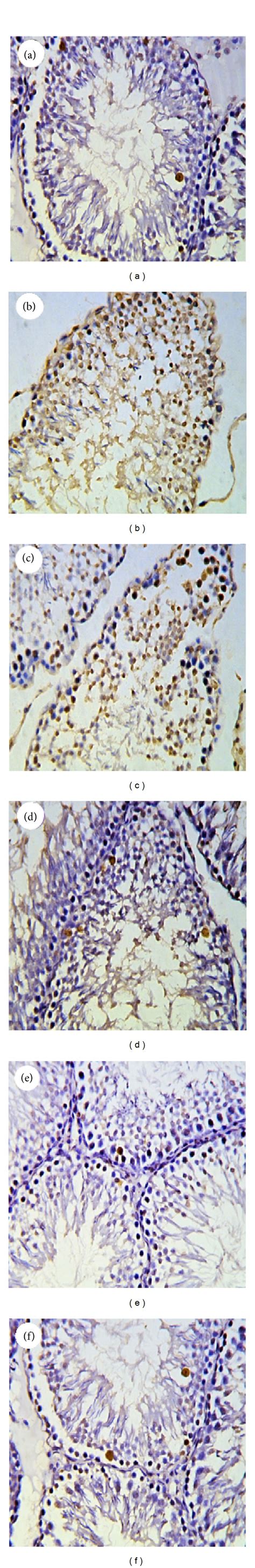 Tunel Staining Of Testicular Tissue ×200 A Sham Group Only A Few