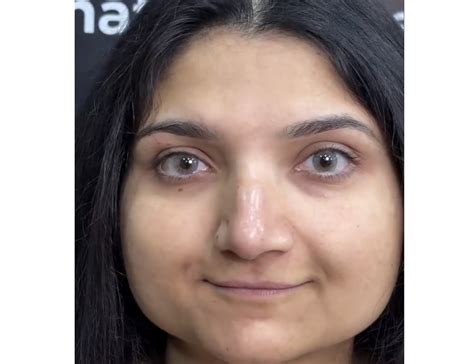 This Young Woman With A Square Face And Cubby Cheeks Got A Makeover That Left Everyone Shocked