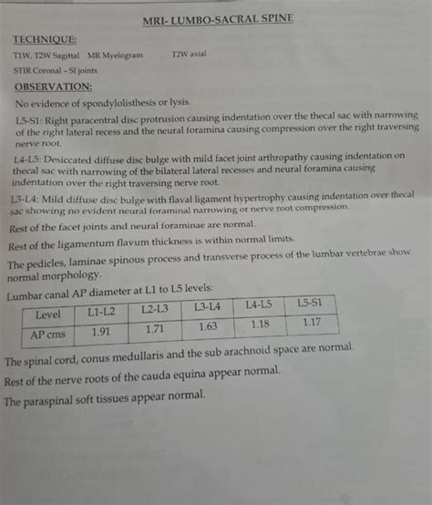 Can Someone Explain R Sciatica