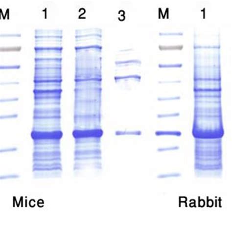 Sds Page 125 For Anti Esp Igg Pab Before And After Purification