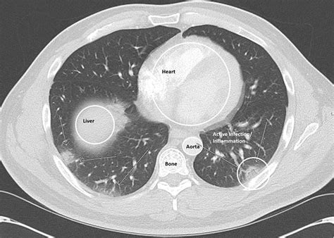 COVID Coronavirus Updates In Victoria BC Page Urban Issues VibrantVictoria