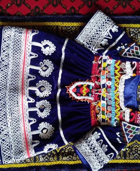 مدل لباس سرپطلونی طفلانه