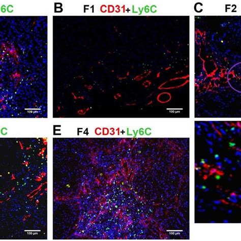 Immunostaining Of Cd11b Myeloid‑derived Suppressor Cells Green And