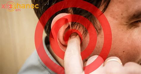 Եթե անընդհատ ականջներում զնգոցներ և ձայներ եք լսում ապա սա պետք է իմանաք