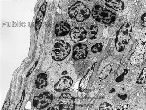 Lymphknoten Drjastrows Em Atlas