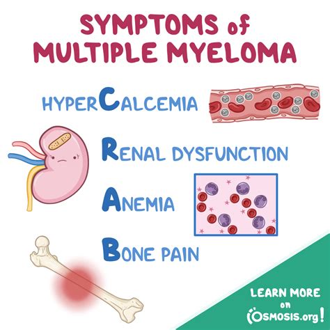 Osmosis From Elsevier Multiple Myeloma Is A Cancer Of Plasma Cells That Produce Antibodies
