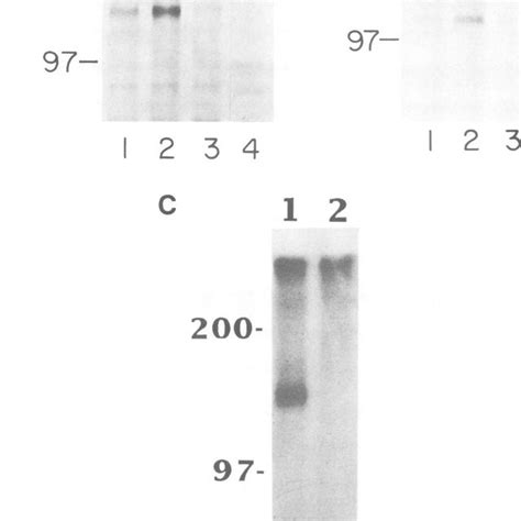 A Immunoprecipitation Of The C Kit Gene Product From Metabolically Download Scientific