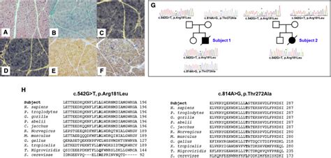 Autosomal Recessive Trmt10c Variants Affect Evolutionarily Conserved Download Scientific