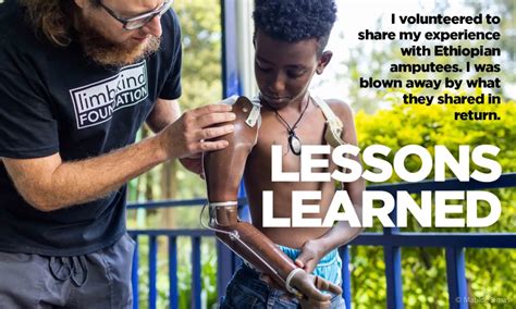 Amplitude Magazine Amputee Information Amputee Lifestyle