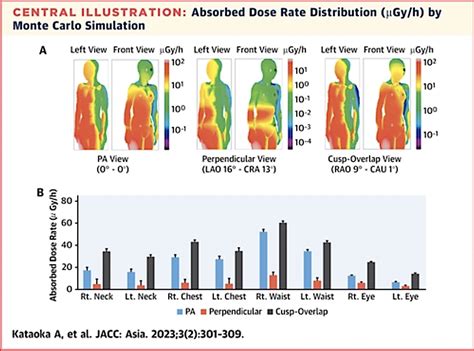 Radiation Exposure In The Cath Lab Tracking The Impact On