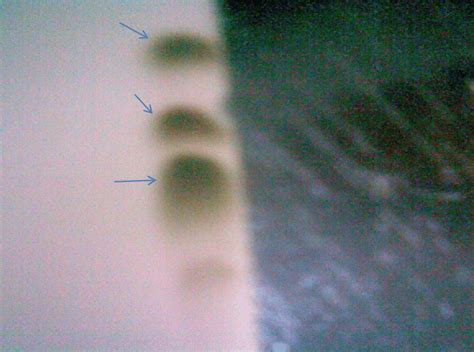 Thin Layer Chromatography Plate Of Three Distinct Compounds Download Scientific Diagram